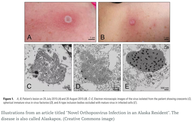 Borealpox. AAAS: “Alaskapox renamed borealpox.” In… | by S. W. Lawrence ...
