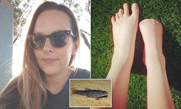 A girl who lost her toes during a fish spa treatment.But how?? | by ...