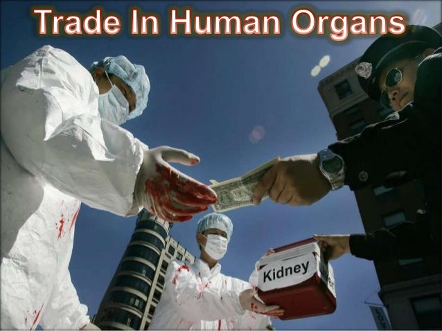 Implications of legalizing human organs sale | by Samuel Maina | Medium