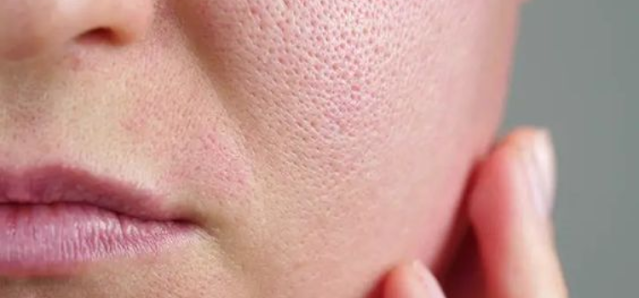 How to Make Skin Less Sensitive - Hammadmustafa - Medium