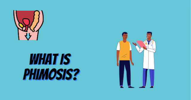 What Is Phimosis, Diagnosis & Causes of this condition - Monikhanmoni ...
