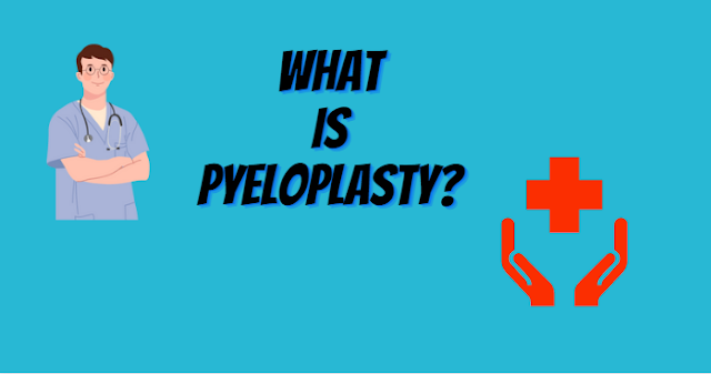What is Pyeloplasty? - Monikhanmoni - Medium
