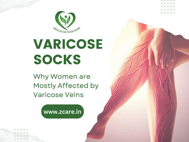 Why Women are Mostly Affected by Varicose Veins ? | by ZCARE | Medium
