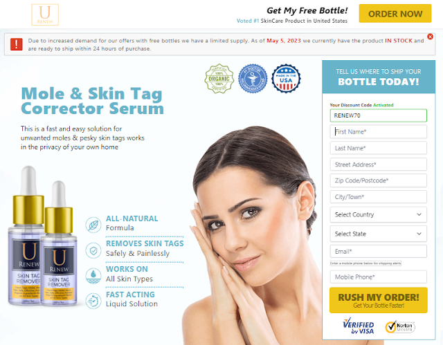 No More Embarrassing Skin Tags with U Renew Skin Tag Remover | by U ...