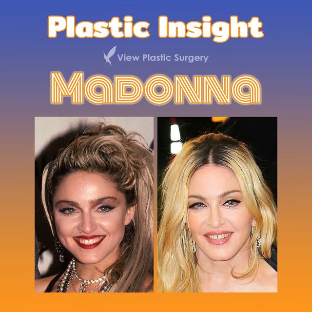 Madonna Before And After