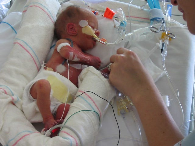 How Should A Premature Infant Be Cared For By Mirza Afzal Baig Medium
