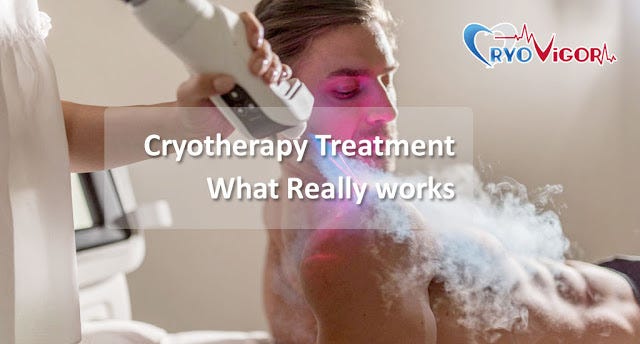 Cryotherapy Treatment — What Really works | by cryovigor | Medium