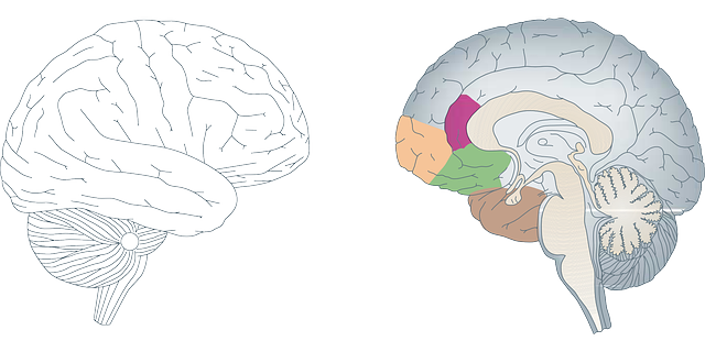 ADHD and Agenesis of the Corpus Callosum | by Christina Szeman | Medium