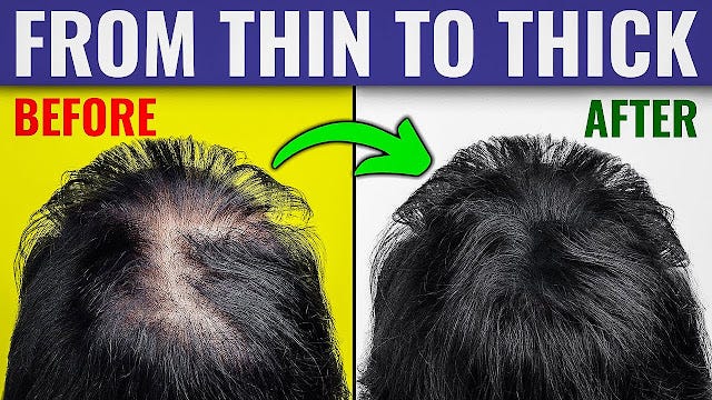 How to Grow Thick and Healthy Hair: Nutrients and Tips | by Mauryayush ...