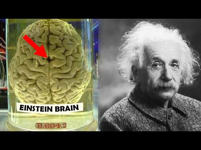 The Tragic Story of Einstein’s Stolen Brain | by Zia Ullah | ILLUMINATION | Jan, 2024 | Medium