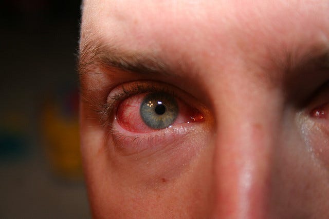 How long does Pink Eye last?. The hatching time of pink eye relies ...