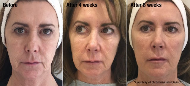 The Psychology of Beauty: Aesthetic Treatments and their Impact on ...