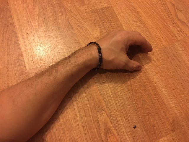 The Day I Decided to Cut Off My Arm | by Anthony Zumpano | Medium
