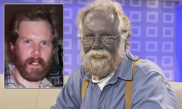 Why Blue People Really Exist. Now this scientifically known… | by Terry ...