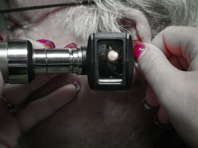 Navigating Minor Hearing Loss: Practical Solutions For A Quieter World ...