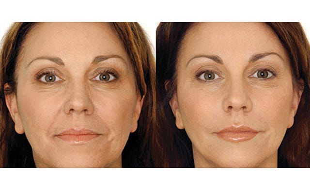 Simply Flawless Cream Get Again Younger Skin | by Health Who | Medium