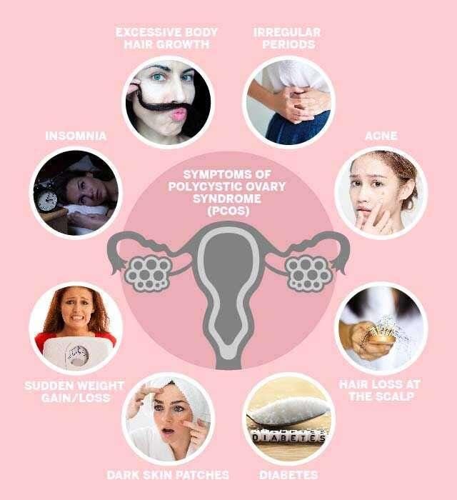 Pcos Symptoms And Treatment