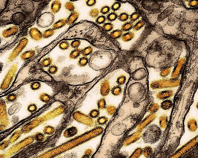 ‘What’s going to happen?’ Tufts scientists race to stay ahead of H5N1 ...