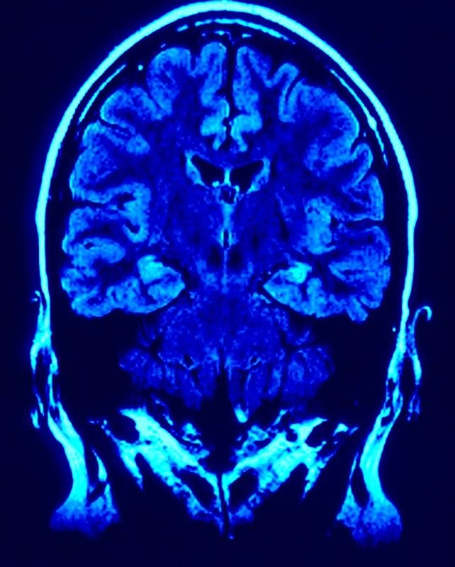 Having Fun With MRIs. What Happens When a Humor Writer Writes… | by ...