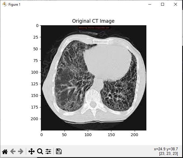 Title: shape and texture of CT and CXR images for lung diseases and ...