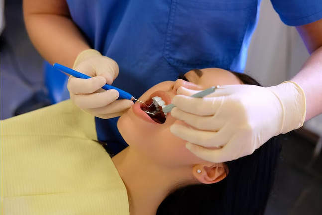Transform Your Smile with Dental Veneers in Solihull: A Complete Guide ...