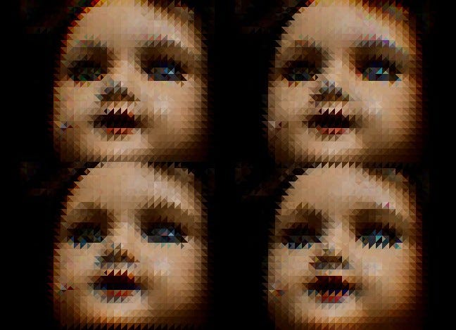 Genain Quadruplets