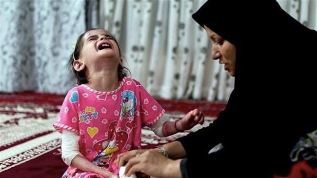 Iranian EB Patients Losing Their Lives over US Sanctions: NGO | by ...