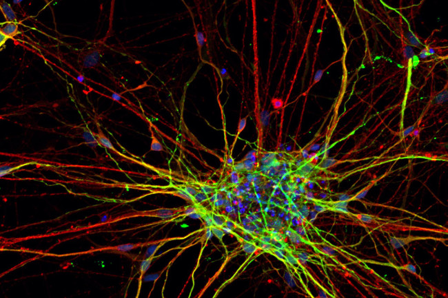 พื้นฐาน Deep Learning (ทฤษฎี): The Neural Network | by lazykern | Medium