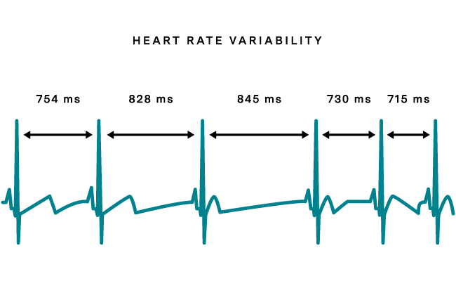 What is Heart Rate Variability and how we could use it? | by Przemek ...