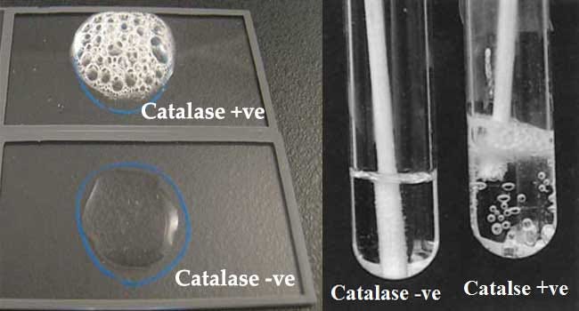 Catalase Test- Principle, Procedure, and Result Interpretation. | by ...