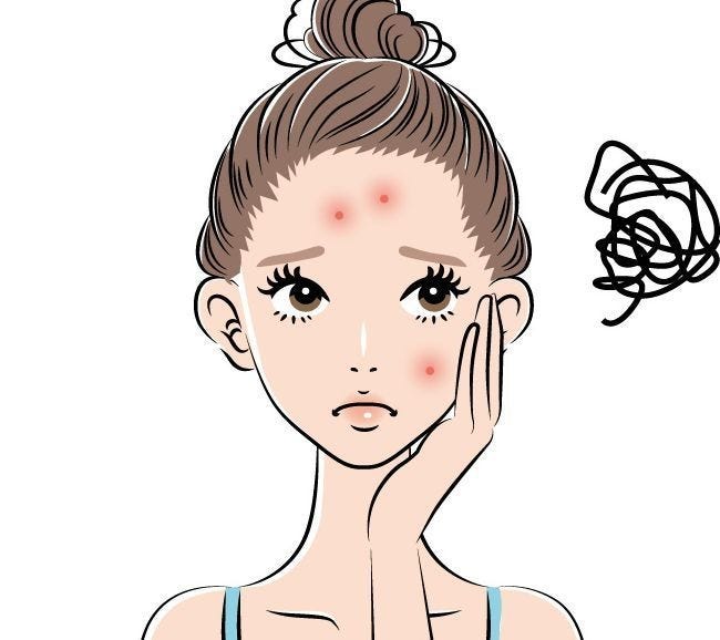 Clear Skin Journey: What I Learned After Years of Fighting Acne | by ...