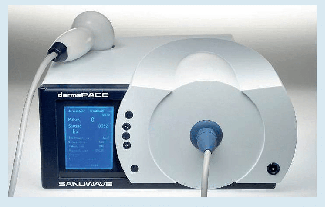 Global Extracorporeal Shock Wave Therapy Device Market Research 2027 ...