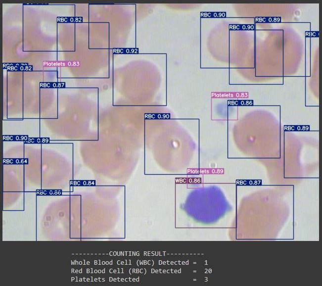 Fast and Accurate Blood Cell Counting with YoLo v7: A State-of-the-Art Object Detection ...