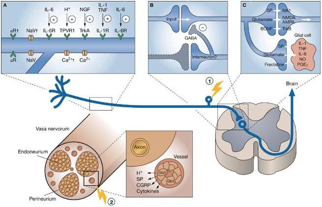 Navigating Life with Fabry Disease: Unraveling the Challenges and ...