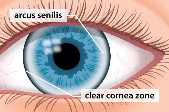 What is the cornea? | by Eye Doctor in Mumbai- Dr Sonia Maheshwari ...