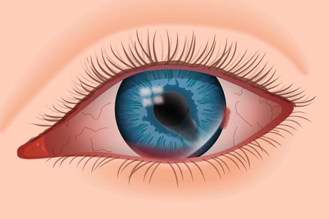 What is ocular trauma? - Dr. Vaidya Eye Hospital - Medium