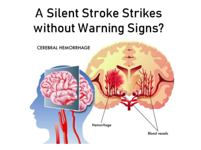 Doctors Warn: If You Can’t Do This Simple Test in One Minute, You Could ...
