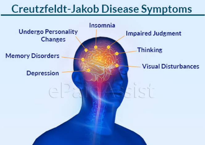 An Unheard of Disease like Alzheimer’s | by Megan Funk | Medium
