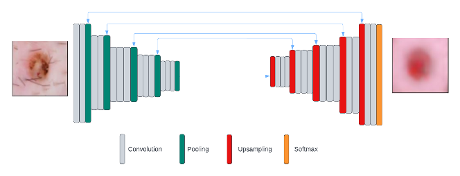 Unveiling the Potential: Skin Disease Detection with Autoencoder and Augmented Intelligence | by ...