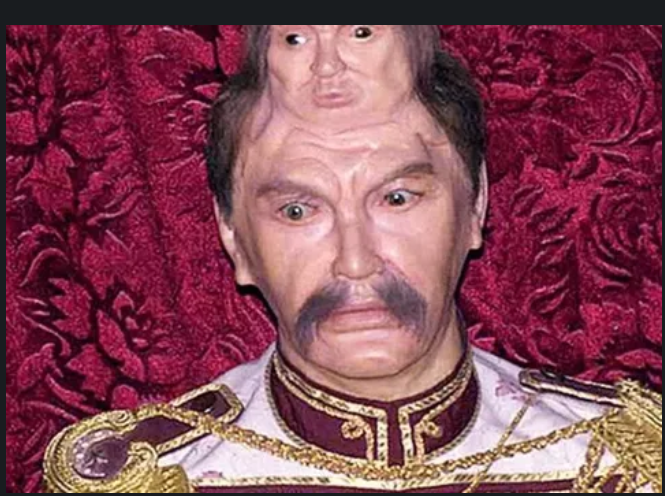 Humans With Two Heads