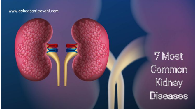 7 Most Common Kidney Diseases - SanjeevEskag - Medium