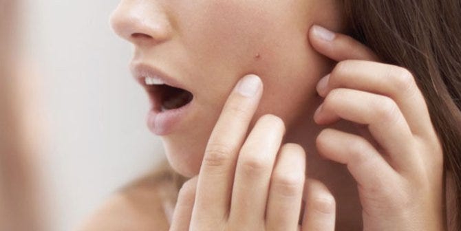 Types of Warts and Best Treatment Options | by hiba Ahmed | Medium