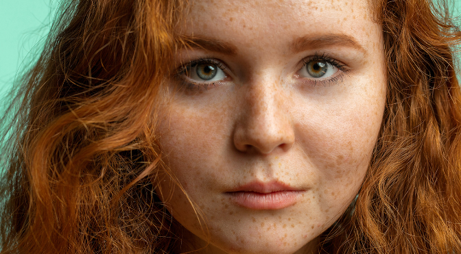 How is the pigmentation on the face formed | by Zhang | Jul, 2024 | Medium