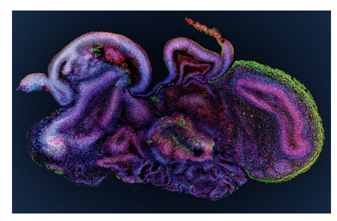 Revolutionizing neuroscience: A comprehensive review on generating ...