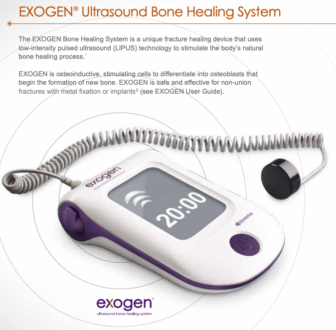 I Have a Fracture, Should I Use the EXOGEN Ultrasound Bone Healing ...