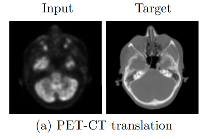 Medical Imaging being Transformed with GAN: MRI to CT Scan and many ...