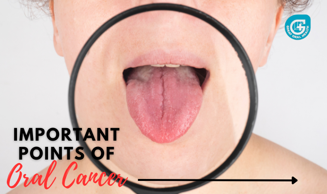 WHAT ARE THE IMPORTANT POINTS OF ORAL CANCER? | by Great Oral Health ...