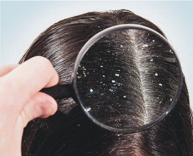 HAIRS- SIGNIFICANT PART OF ONE’S OUTER APPEARANCE | by Drhealth Clinic ...