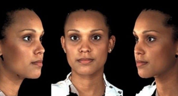 Accurate OPG Dental Imaging for Comprehensive Diagnostics - ctdent - Medium