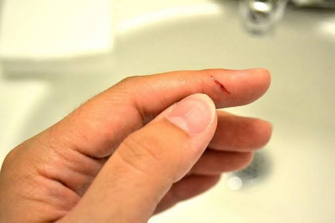 Paper cuts. The Emotional Side Effects of Papercuts… | by Sylveeyah ...